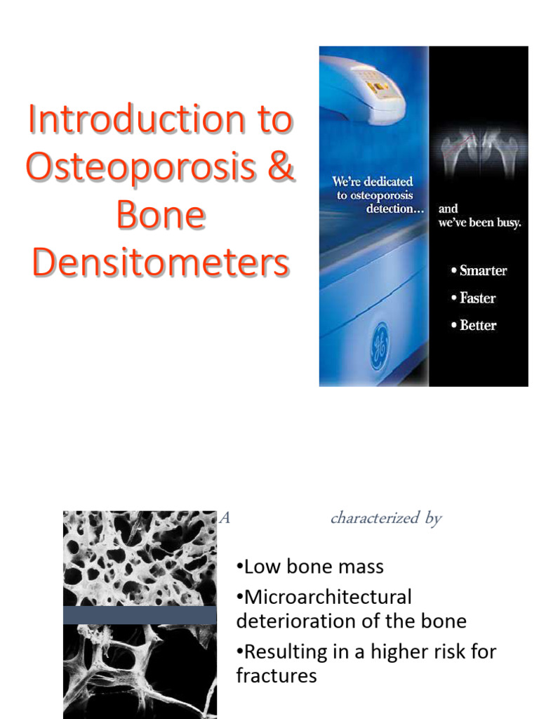 Introduction To Osteoporosis & Bone Densitometers | PDF | Bone ...