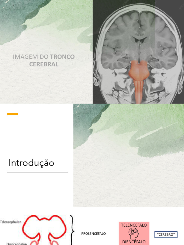 Anatomia do Tronco Cerebral em RM 3.0T | PDF | Neurociência | Neuroanatomia