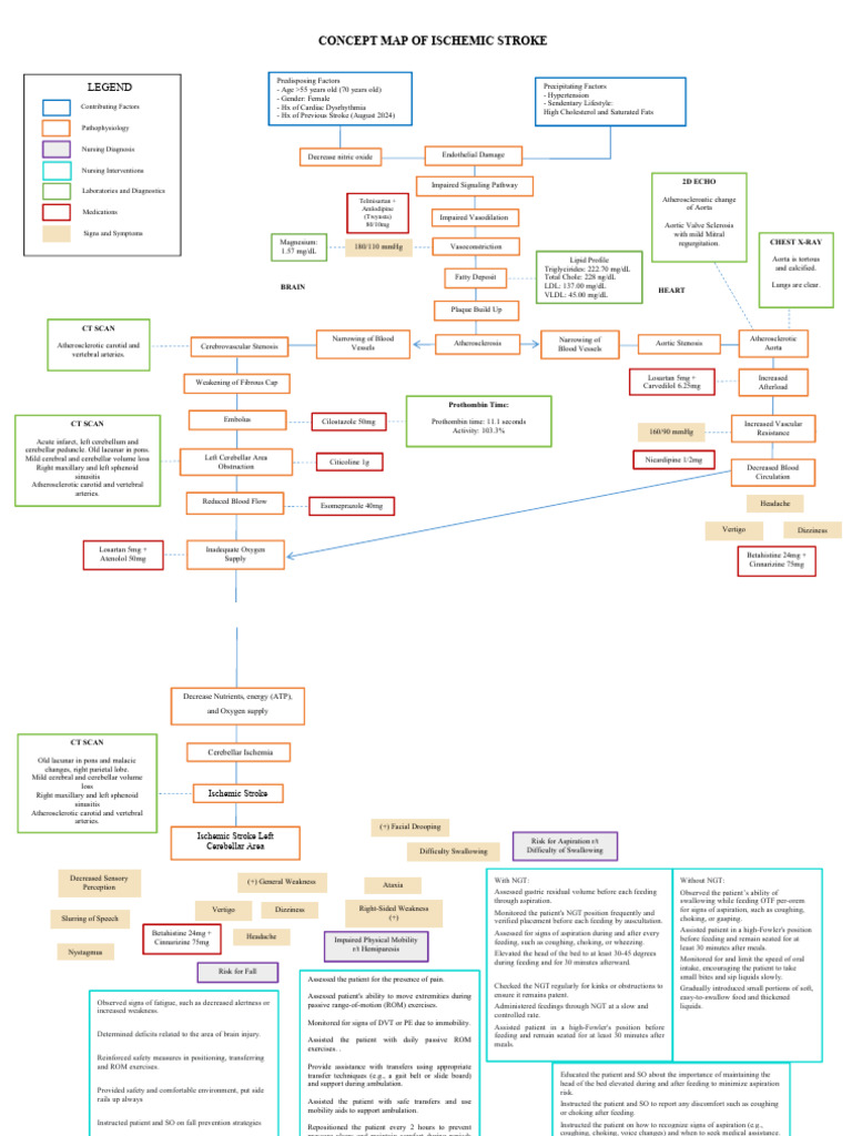 Ischemic Stroke Concept Map Final | PDF | Atherosclerosis | Stroke