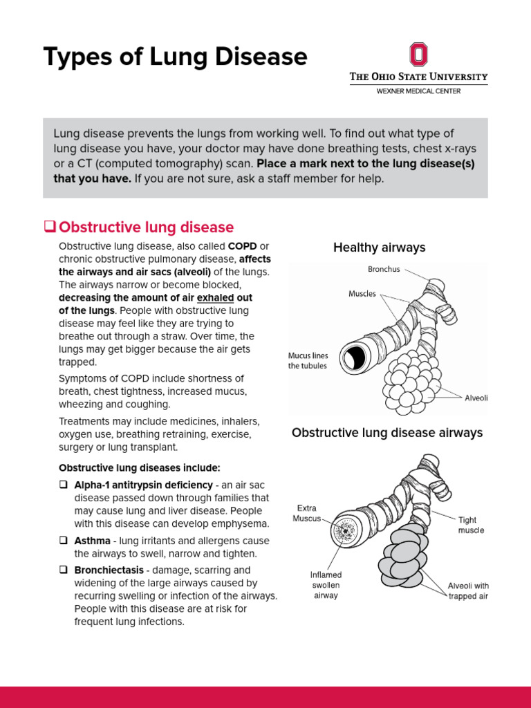 Types-Lung-Disease The Ohio State University Wexner Medical Center ...