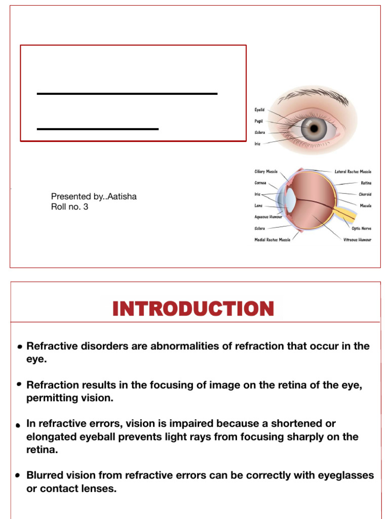Refractive Error | PDF