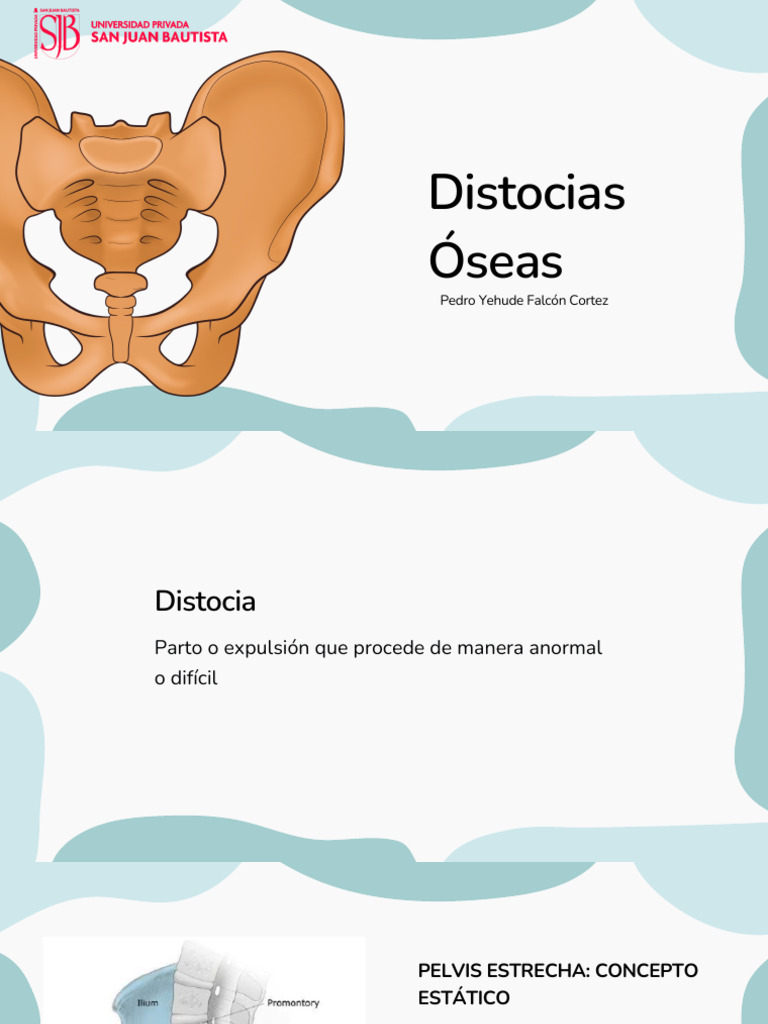 Distocias Oseas | PDF | Parto | Pelvis