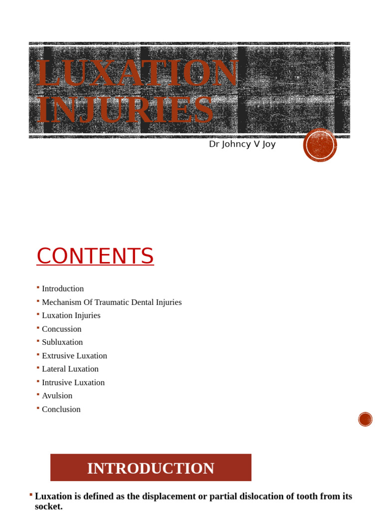 Luxation Injuries New | PDF | Human Tooth | Periodontology