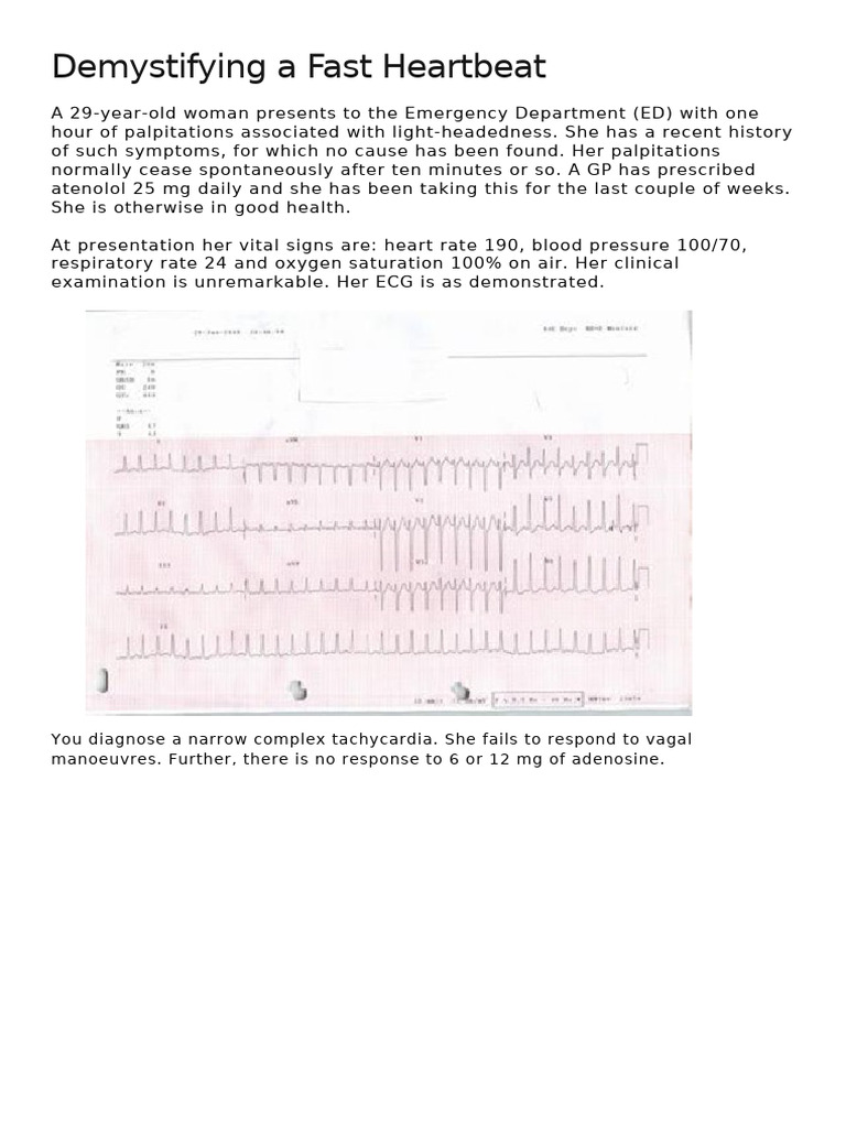 Demystifying A Fast Heartbeat | PDF | Cardiovascular Physiology | Cardiac Electrophysiology
