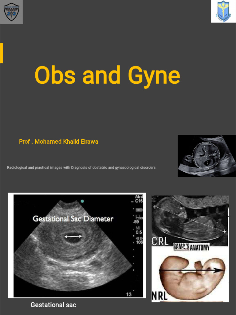 CRL and Imaging in Obstetrics | PDF