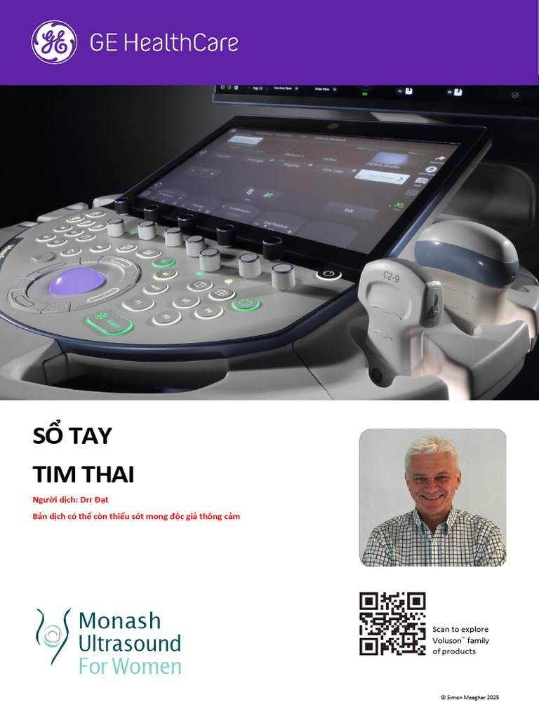 2025 - Voluson - Fetal Cardiac Handbook - Prof Simon Meagher ...