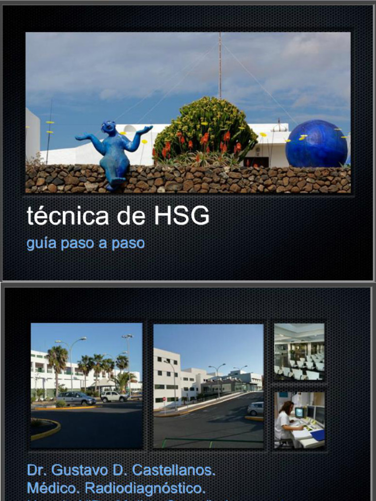 HSG | PDF
