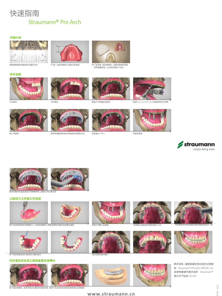 Straumann® Pro Arch 快速指南 | PDF