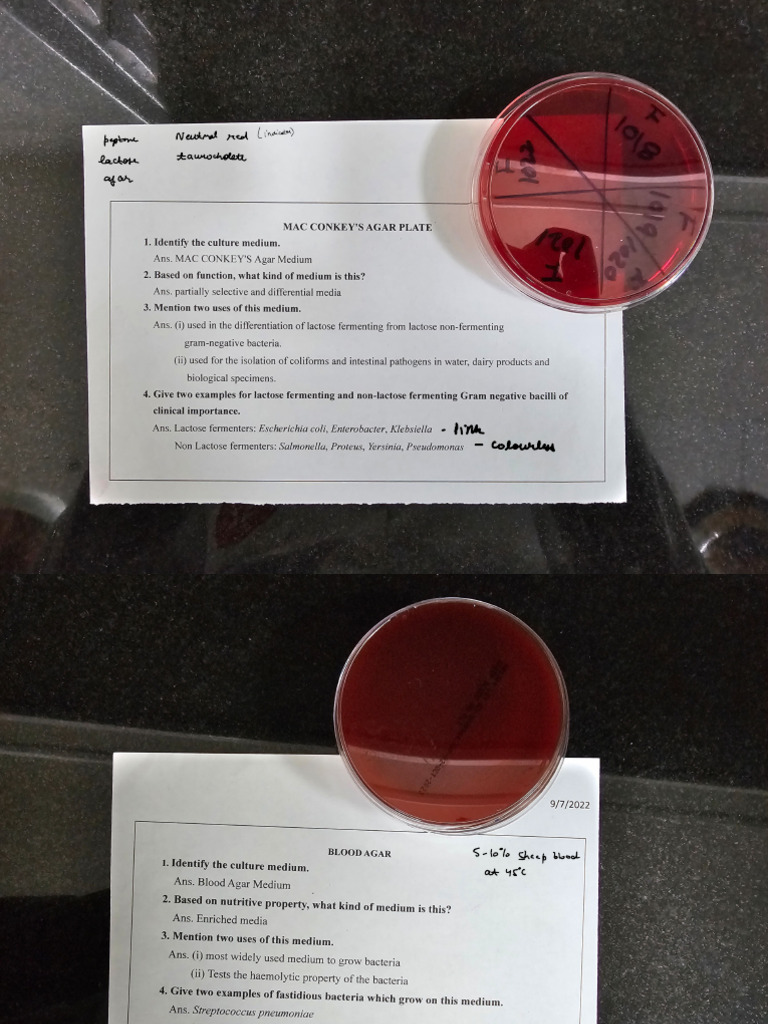 Selective Media for Enteric Pathogen Isolation | PDF