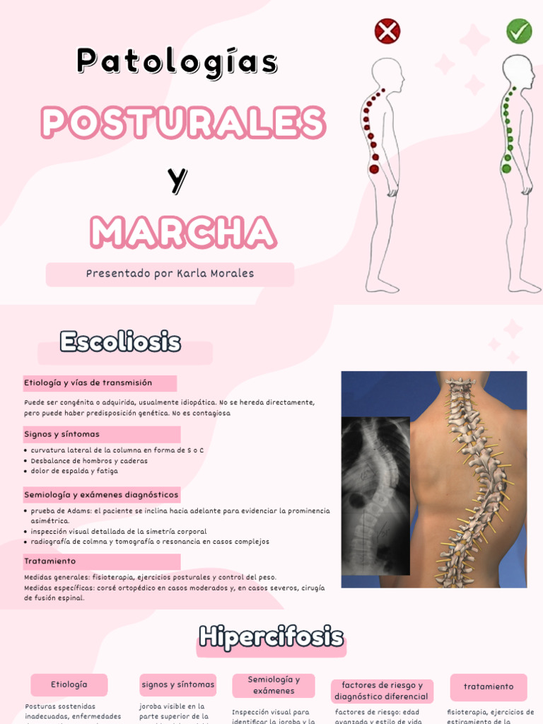Trastornos Posturales y de Marcha | PDF | Rodilla | Pie