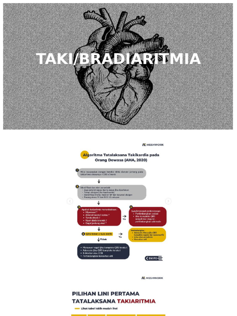 Takiaritmia | PDF