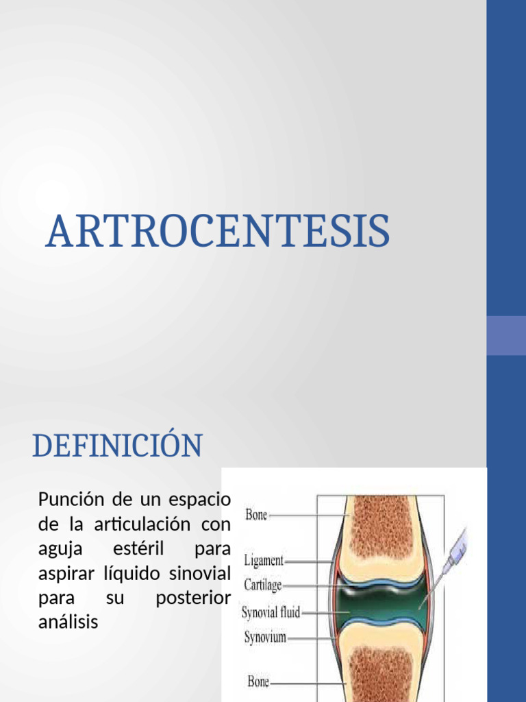Artrocentesis: Definición y Usos | PDF