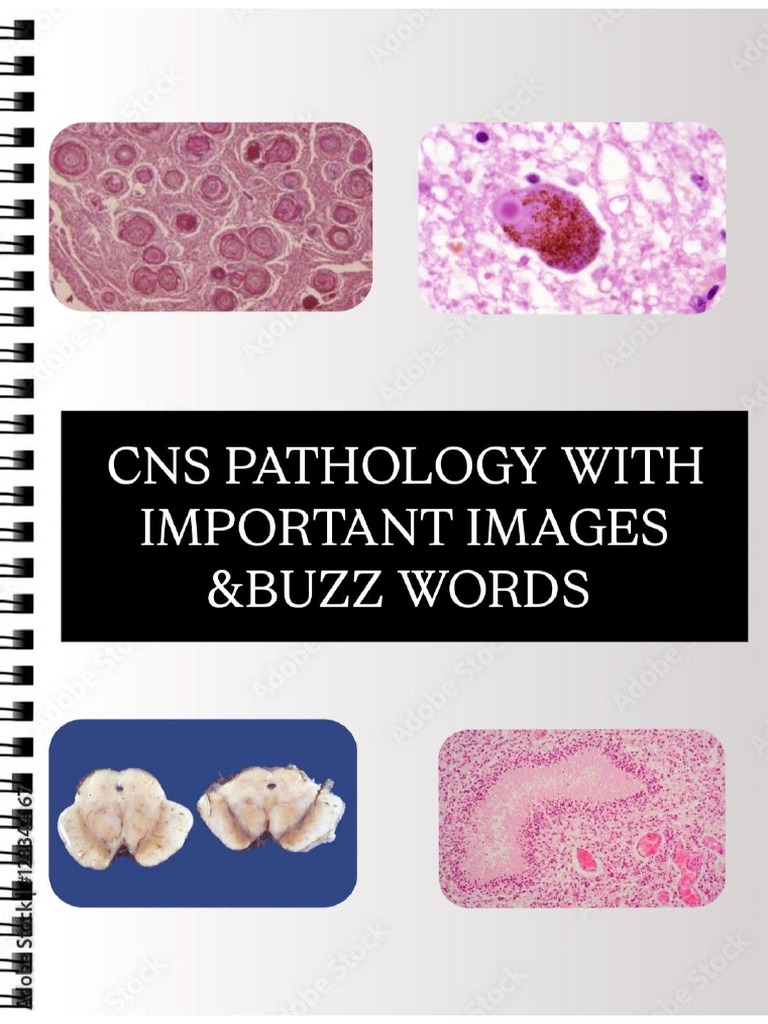 CNS Pathology | PDF