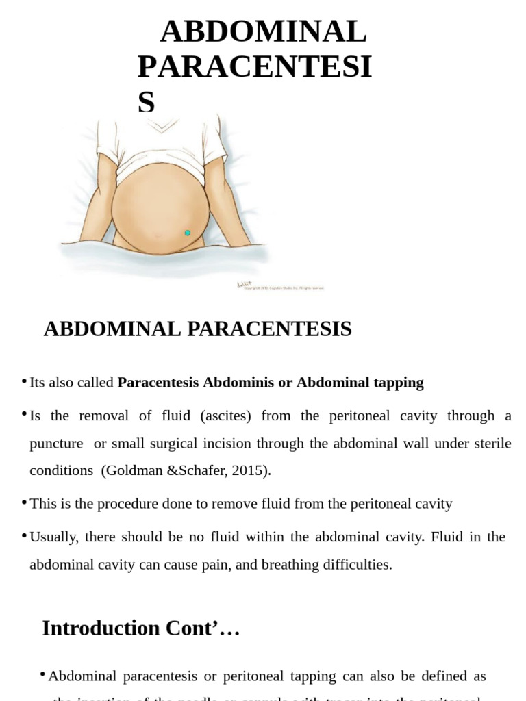 Abdominal Paracentesis | PDF | Medical Specialties | Clinical Medicine