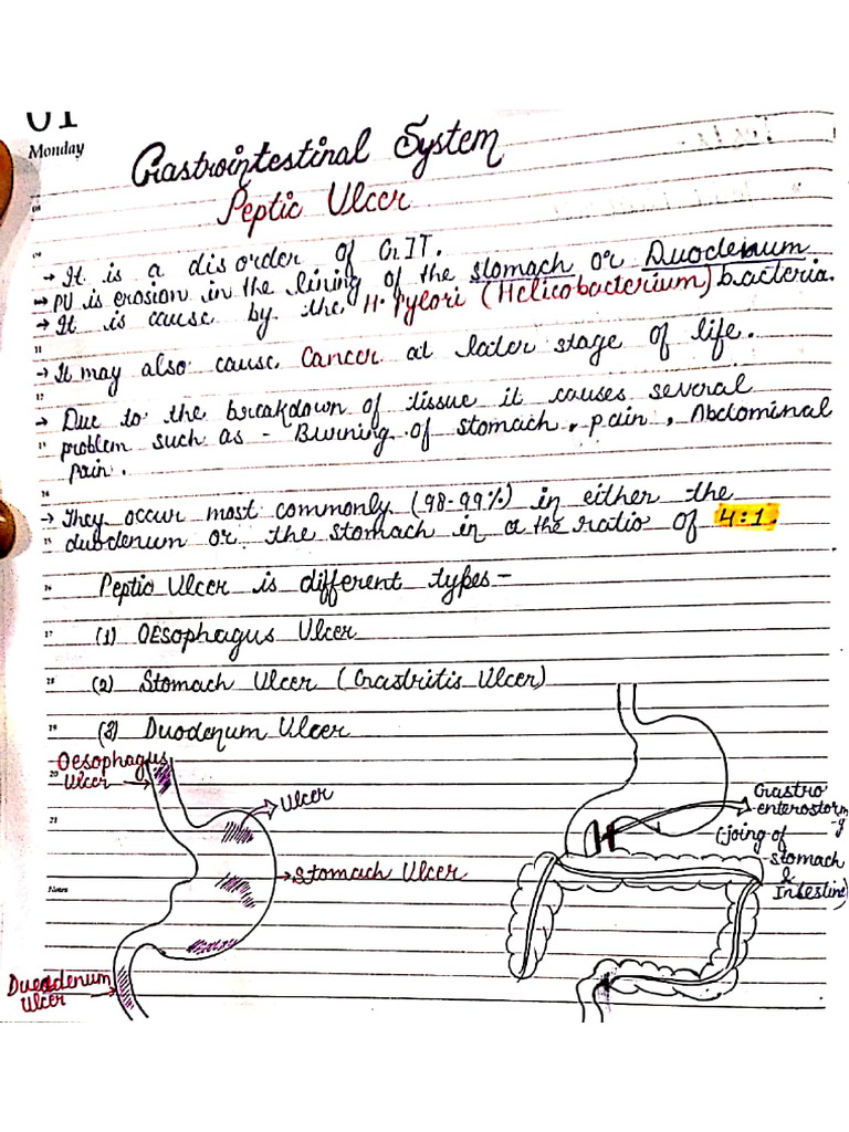 Peptic Ulcer | PDF