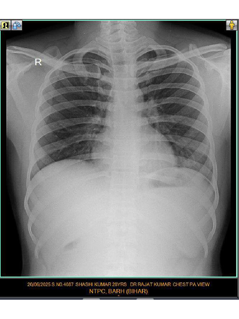 4087 Shashi Kumar | PDF