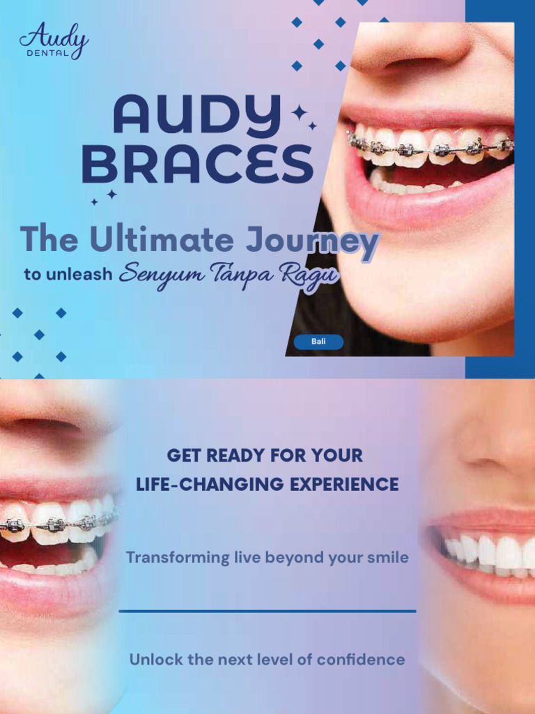 Katalog AUDY Braces 26 Juni Bali Lowrest | PDF