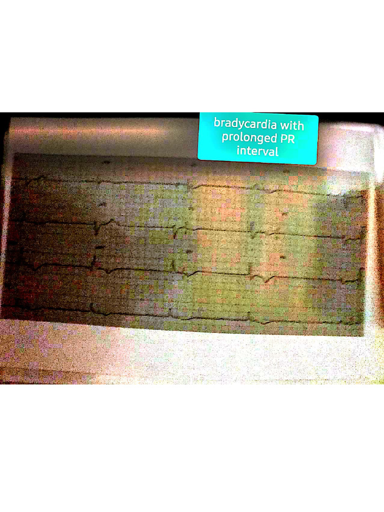 Medicine Charts | PDF