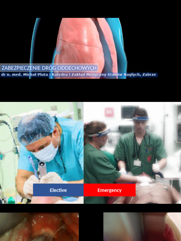 Instrumented Airway Protection | PDF