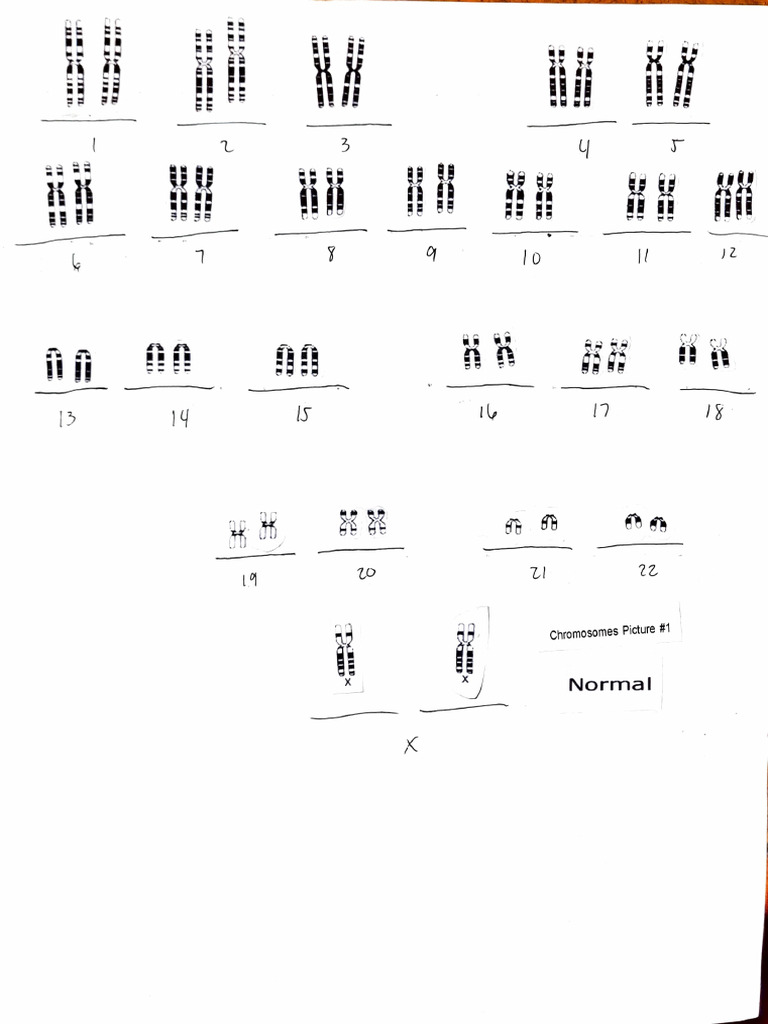Stevens Karyotyping | PDF
