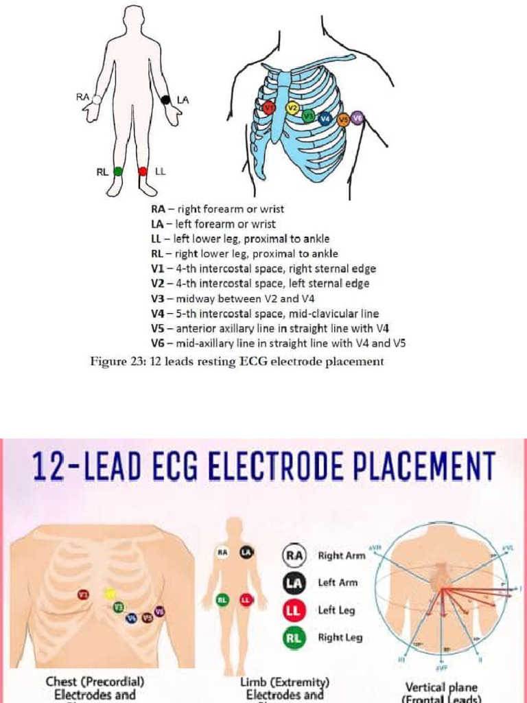 ECG Lead Position With Direction | PDF