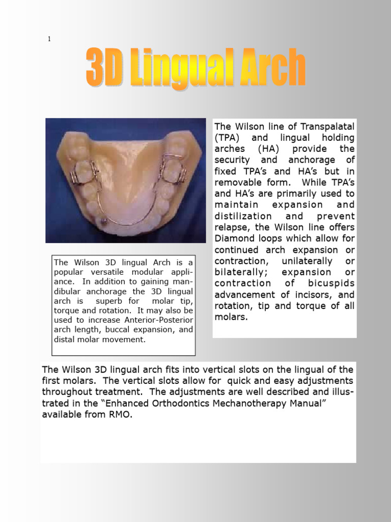Wilson 3D Lingual Arch Overview | PDF