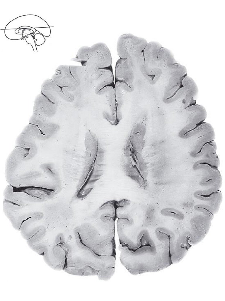 Lab 4 - Horizontal Brain Slices | PDF