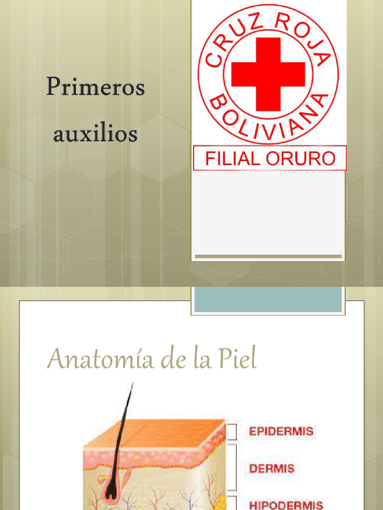 Tema 13 Quemaduras | PDF | Quemar | Piel