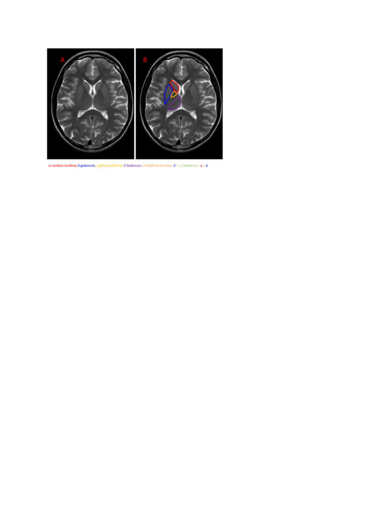 Anatomi Brain Mri 2 | PDF