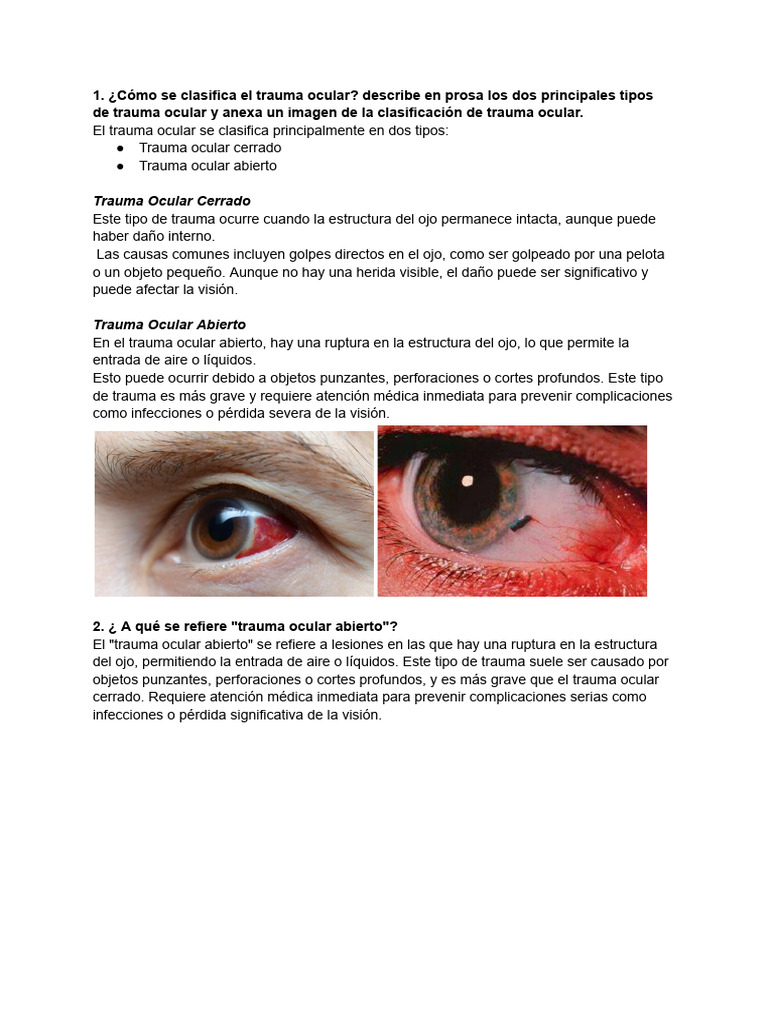 Clasificación y Evaluación del Trauma Ocular | PDF | Percepción visual ...