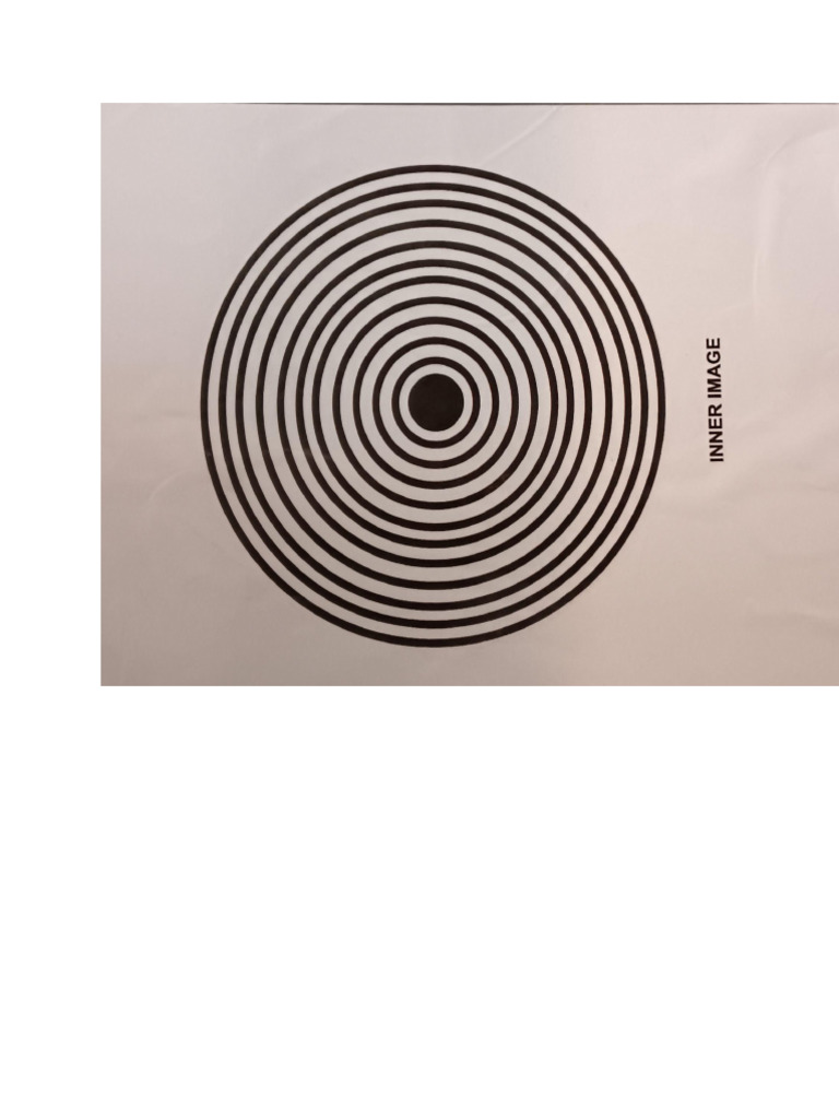Astigmatism Ex. Chart | PDF