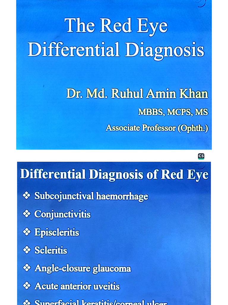 Red Eye | PDF