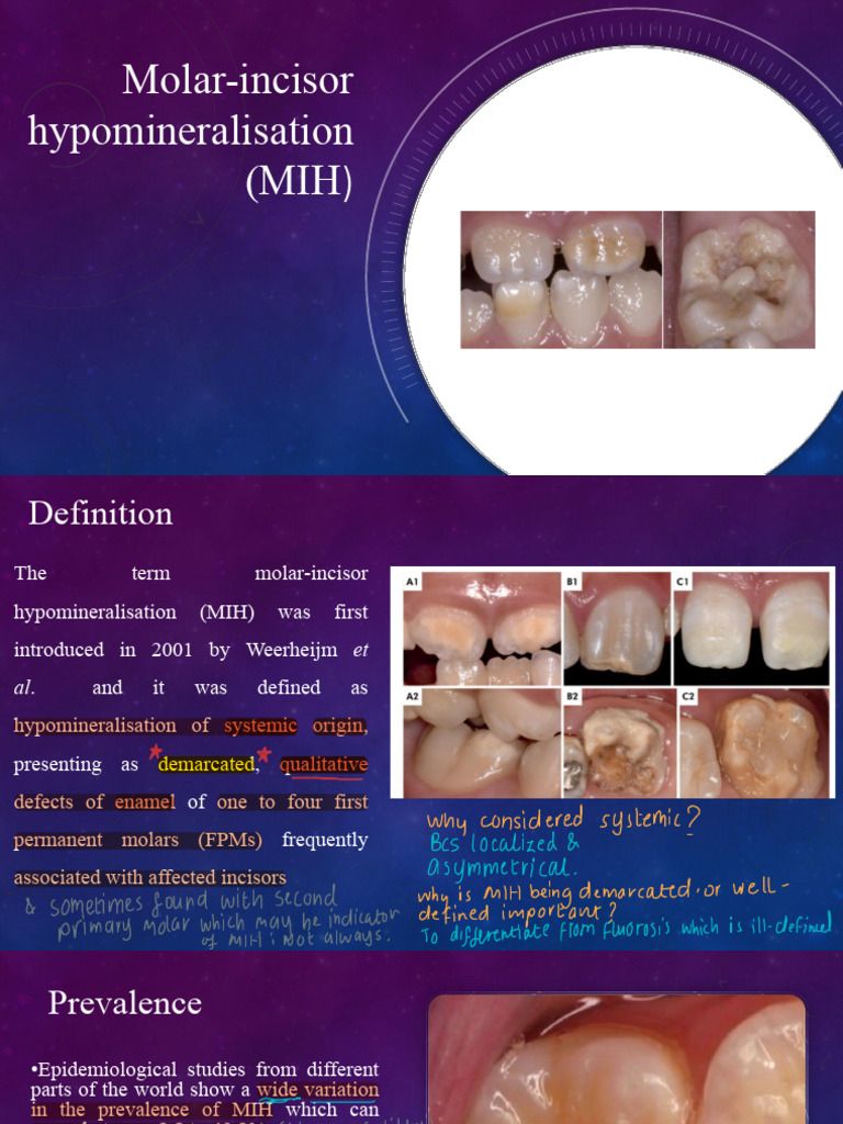 MIH Calsification and TTT Index Wurzburg | PDF | Tooth Enamel | Human Tooth