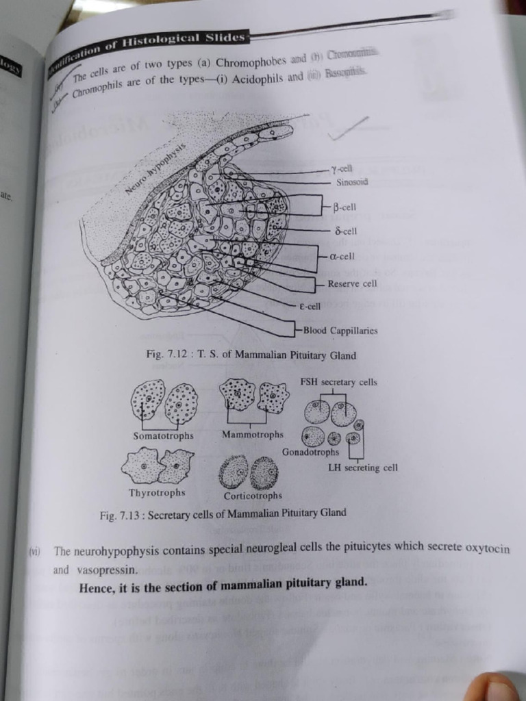 Pituitary Gland TS | PDF