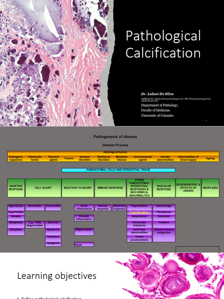 Overview of Pathological Calcification | PDF | Inflammation | Pathology