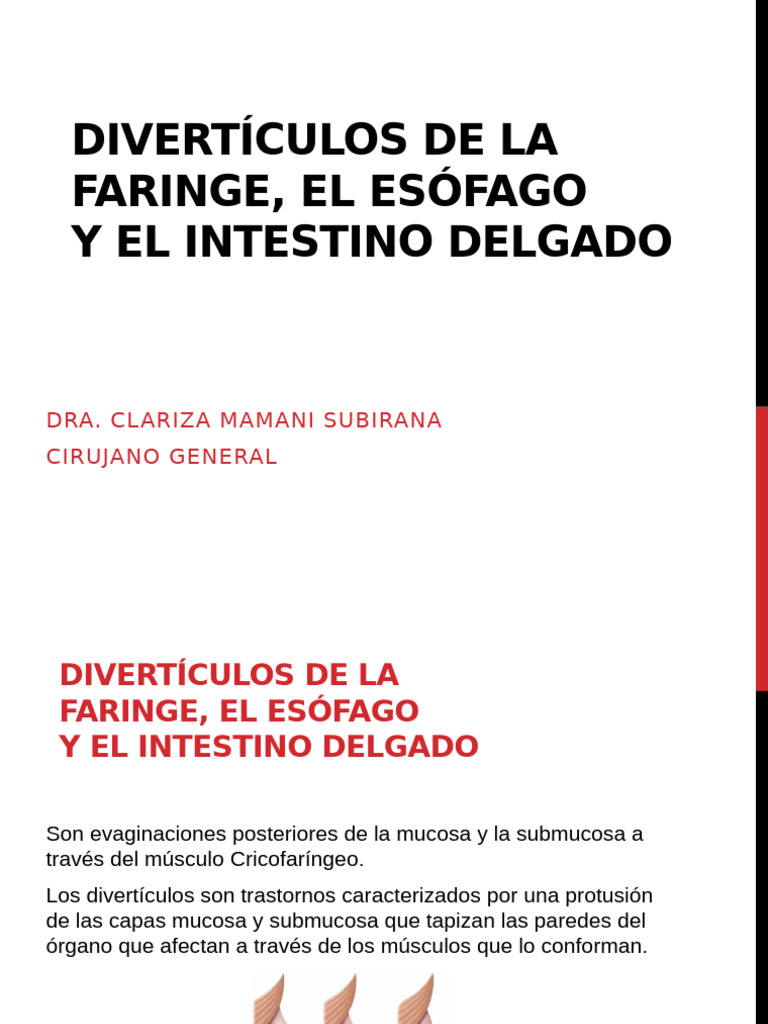 Divertículos de La Faringe, El Esófago | PDF