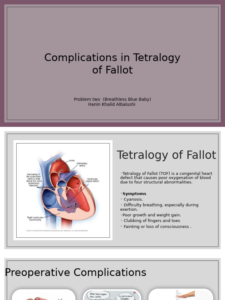 Complication of Tetralogy of Fallot | PDF