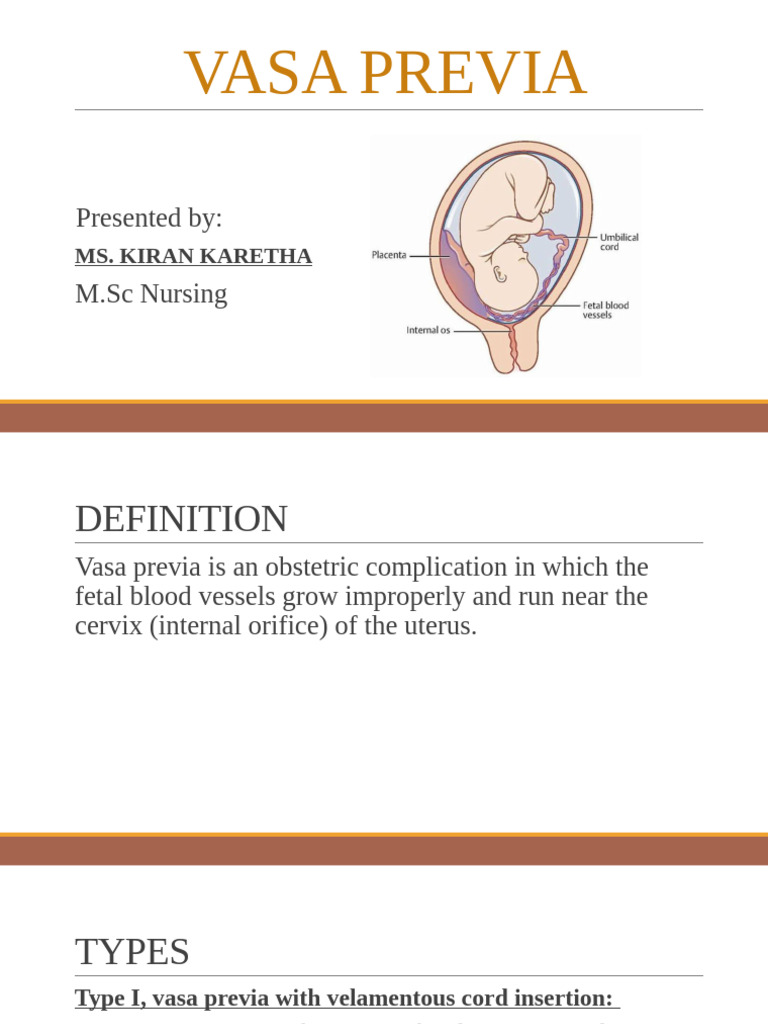 21. Vasa Previa | PDF