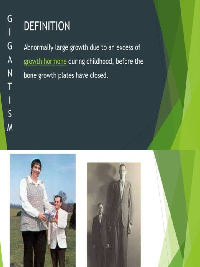 Gigantism | PDF
