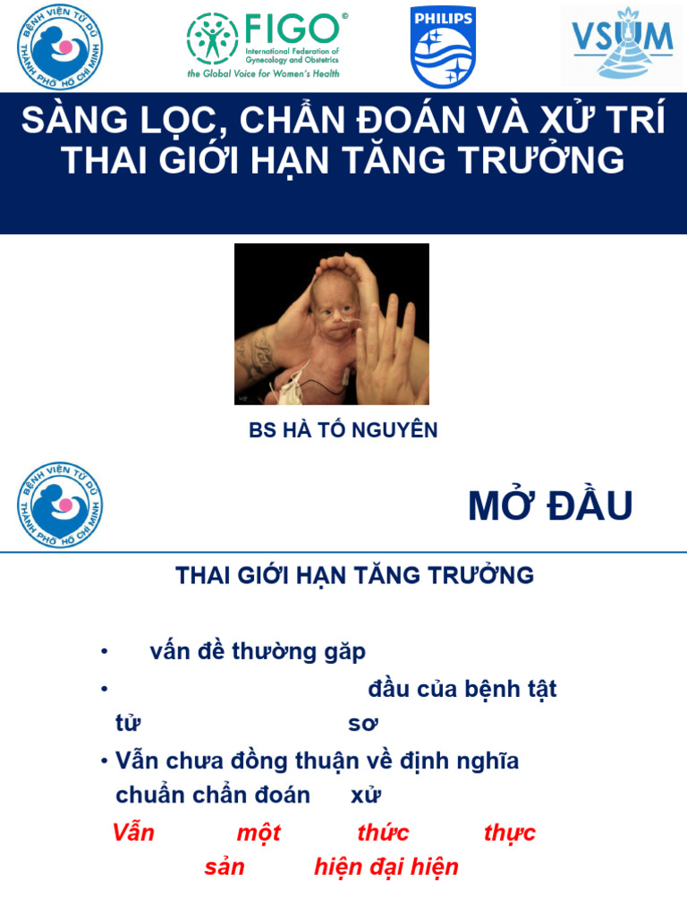 Buoi 1 Sang Loc Chan Doan Va Xu Tri Thai Gioi Han Tang Truong Theo ...