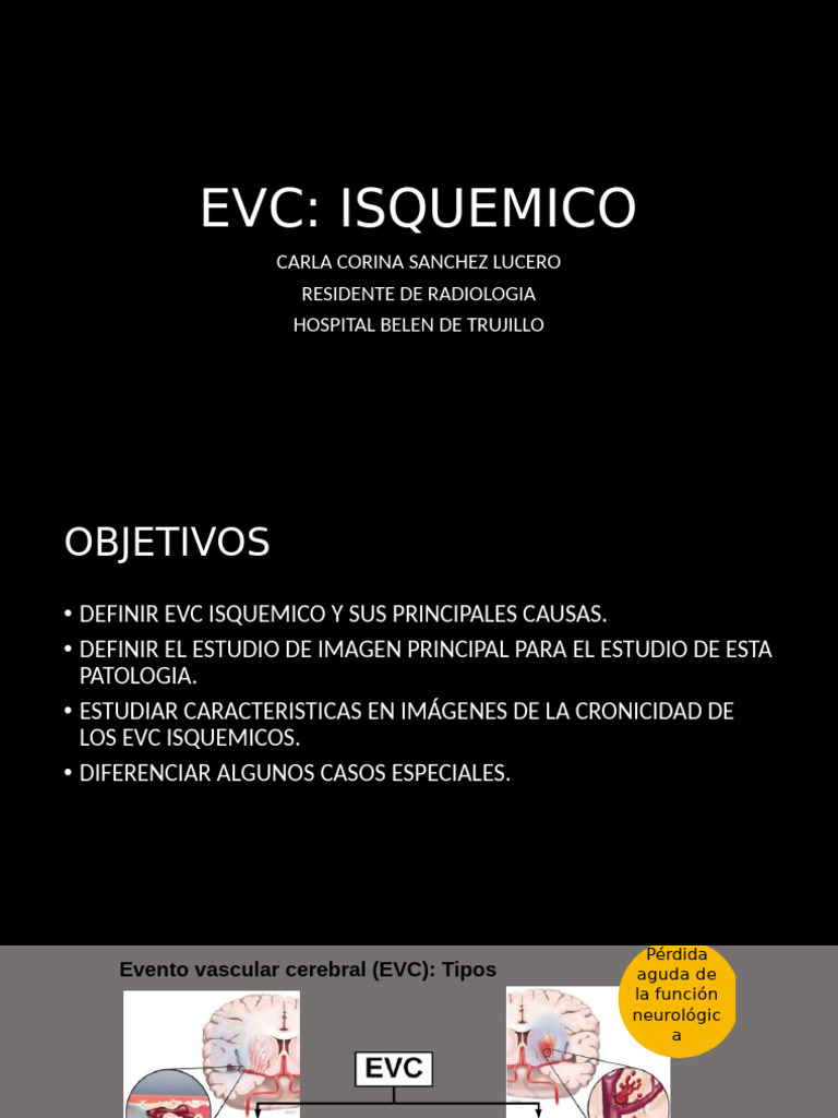Evc Isquemico | PDF | Carrera | Ganglios basales