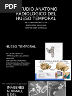 Ángulo Cérvico-Diafisario del Fémur | PDF
