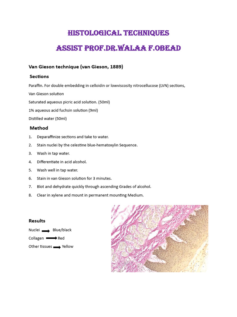 Histological Techniques Assist Prof - Dr.Walaa F.Obead: Van Gieson Technique (Van Gieson, 1889 ...