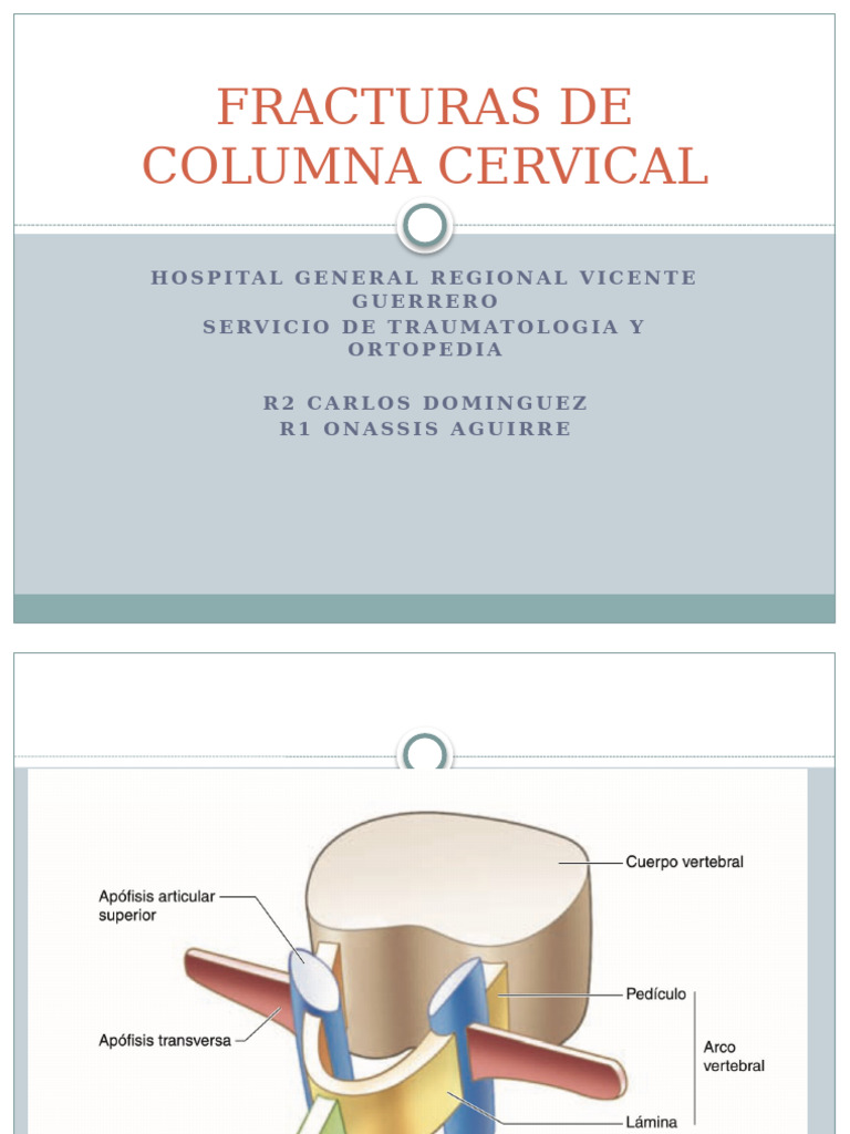 Fracturas de Columna Cervcalll | PDF
