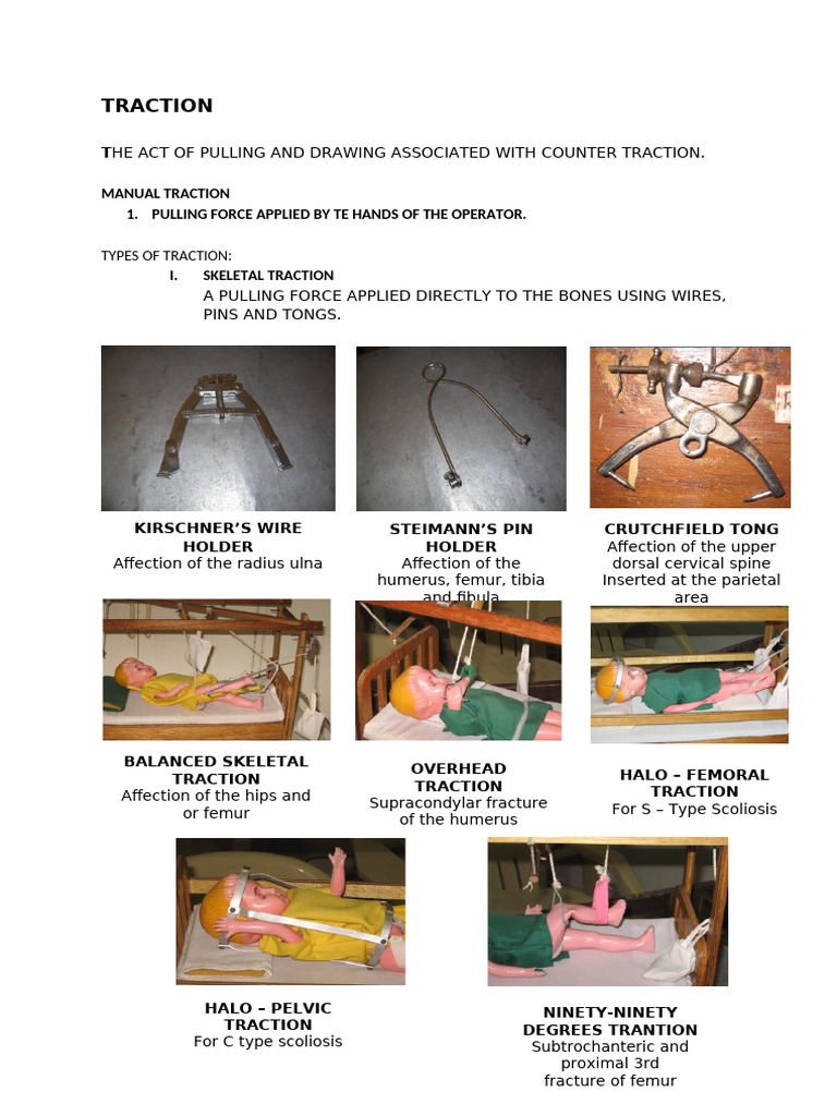 Types and Techniques of Traction | PDF | Hip | Human Leg