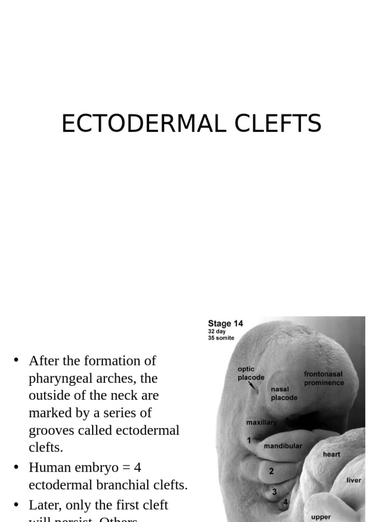 Pharyngeal Clefts and Pouches 2 | PDF | Human Anatomy | Anatomy