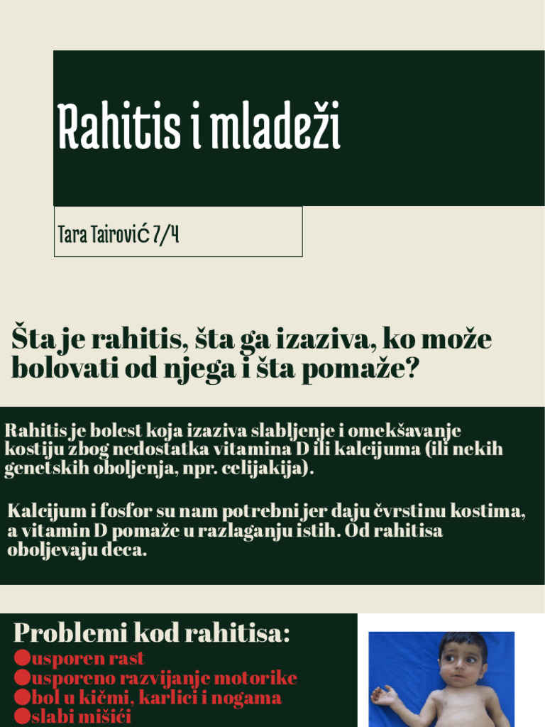 Rahitis I Mladezi | PDF