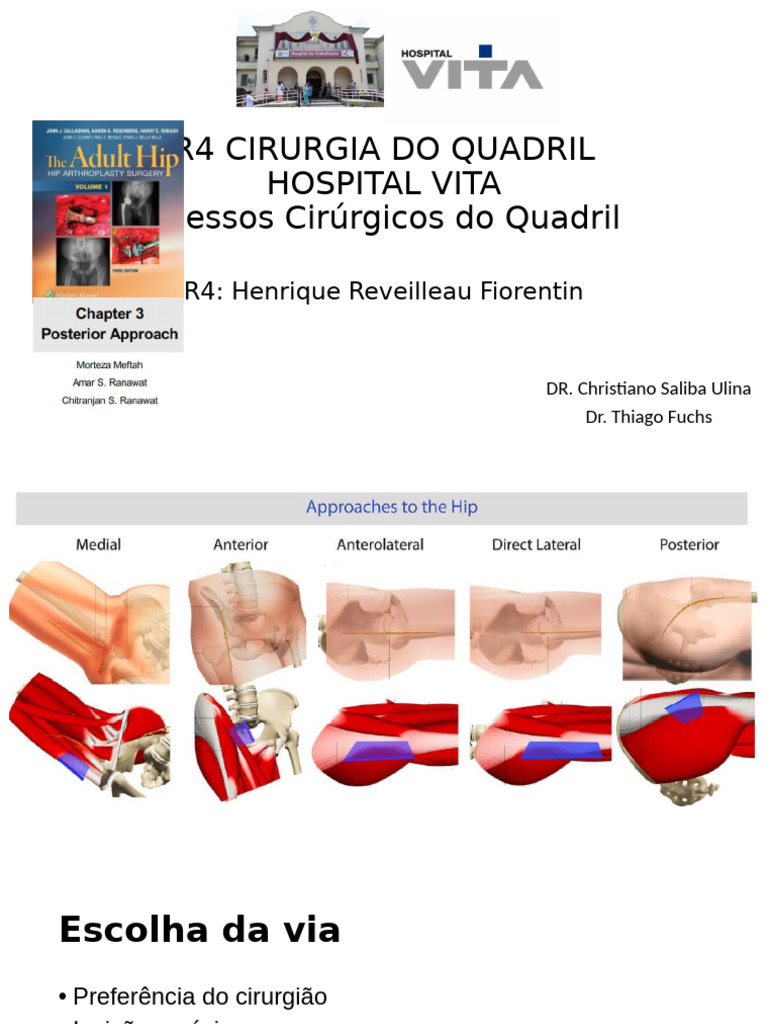 Acessos Quadril - Henrique Apresentar 2 | PDF | Pélvis | Quadril