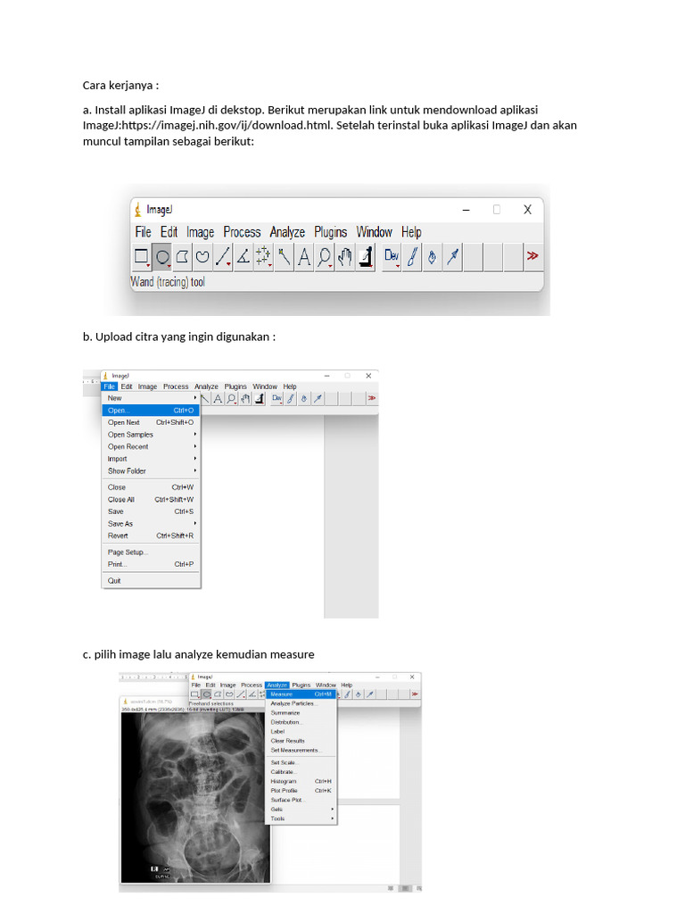 Histogram ImageJ Abdomen | PDF