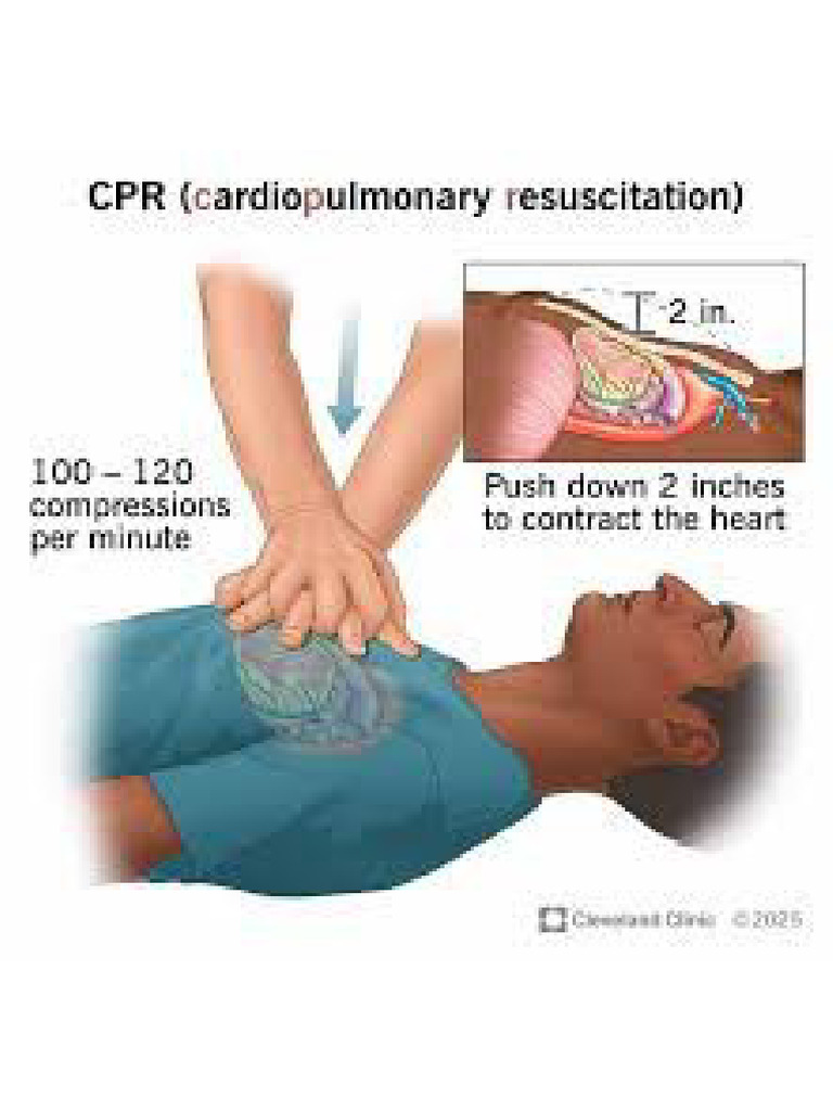 CPR | PDF